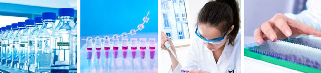 Antibody Library | Antibody Design Labs